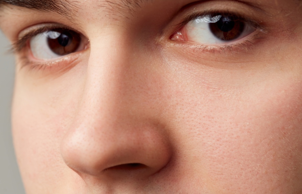 Nose Anatomy 101 and How Saddle Nose Deformity Occurs | New York, NY